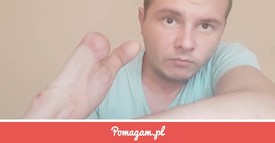 Zrzutka na Przeszczep Dłoni, Samotny Ojciec - Patryk Pałaszewski | Pomagam.pl