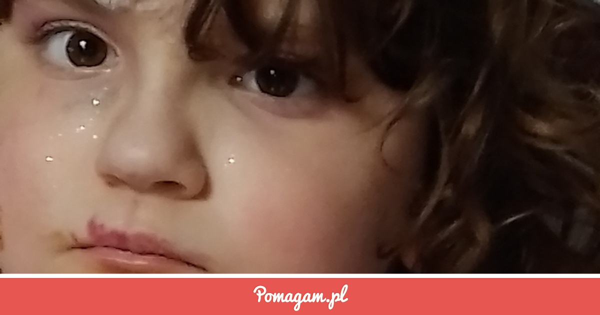 Zrzutka na Leczenie Zuz - Tomek Maćkowiak | Pomagam.pl