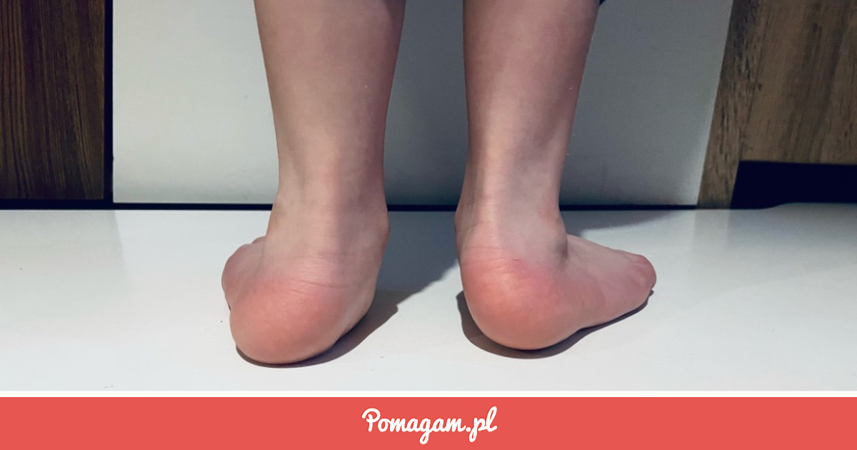 Zrzutka na Pierwszy Bezbolesny Krok Lenki - FUNDACJA "SERCA dla MALUSZKA" | Pomagam.pl