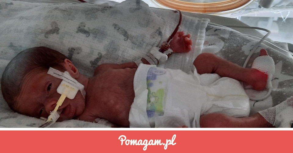 Zrzutka na Nasz Mały CUD - 850Gram Borysek - Magdalena Gadowska ...