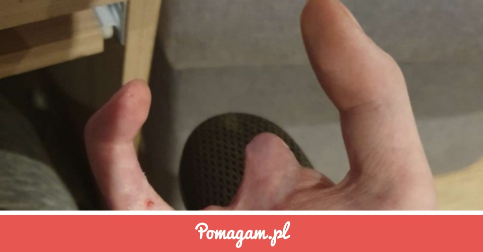 Zrzutka na Na Proteze Dla Dawida 2 część - Dawid Moszczyński | Pomagam.pl