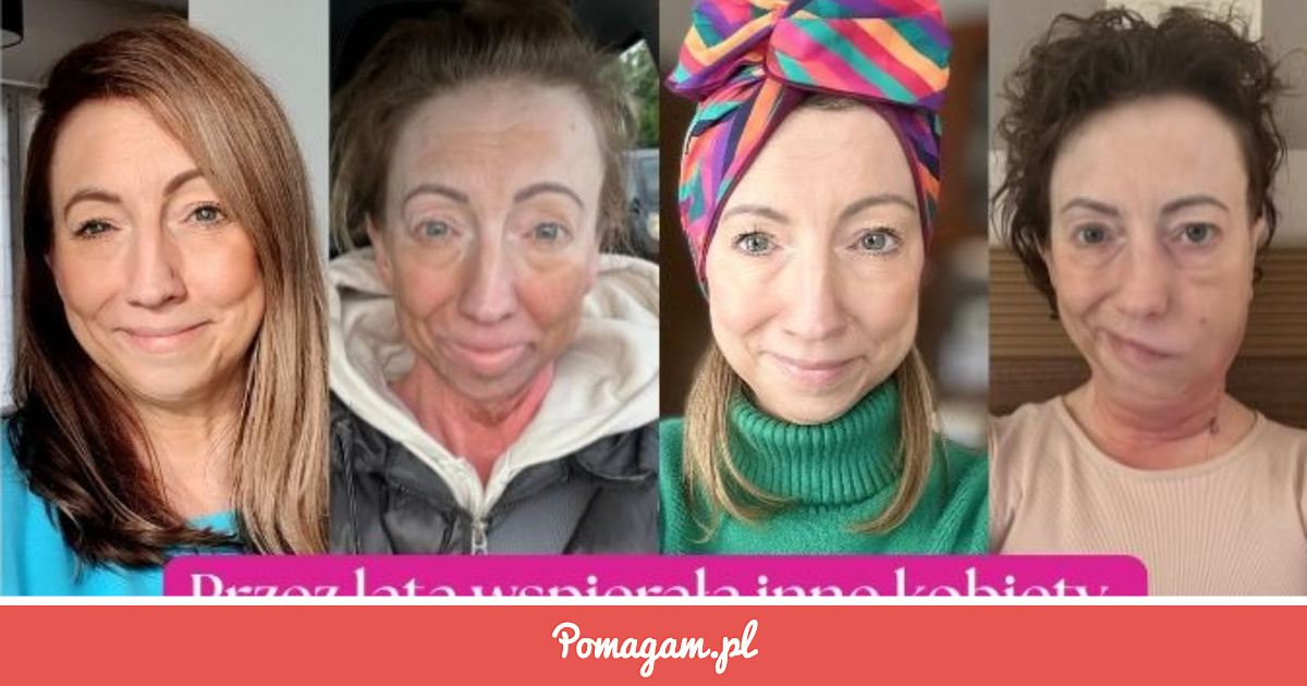 Zrzutka na Leczenie Nowotworu i Przeszczep - Katarzyna Zegarowicz ...