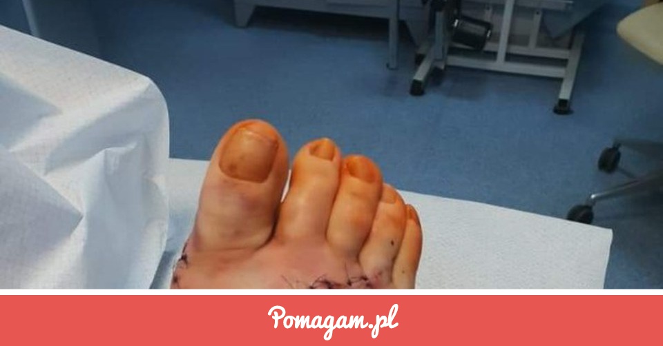 Zrzutka na Dla Hani. na Operację Stopy - Ewa Anastazja | Pomagam.pl