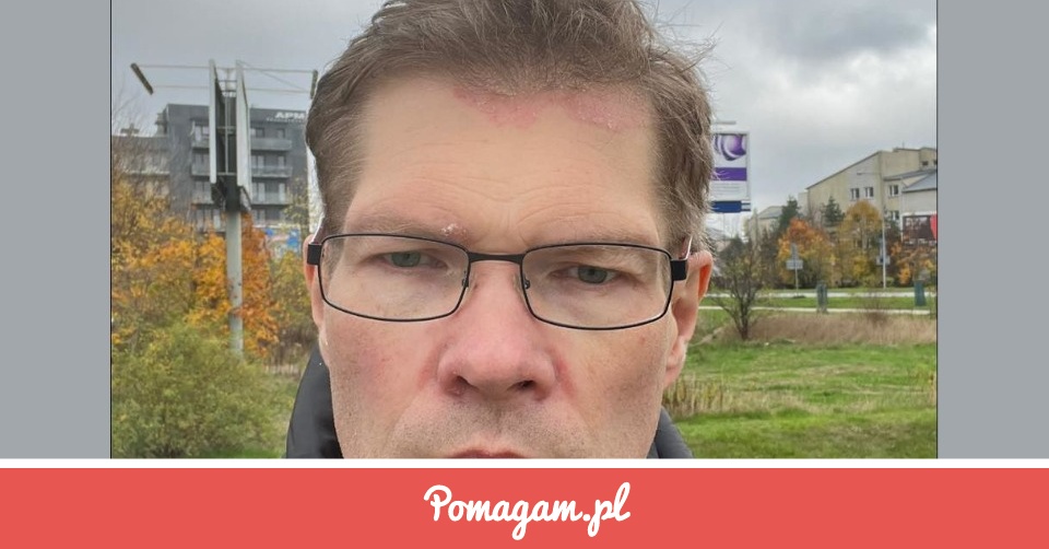 Zrzutka na Ładowarka do Aparatów Słuchowych - Adam Banach | Pomagam.pl