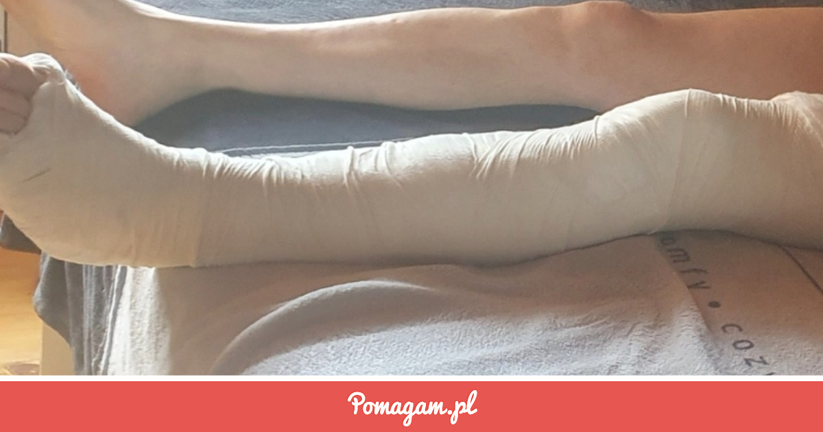Zrzutka Na Operacja Wi zad a ACL ALL Olga Cudny Pomagam pl Zrzutka Na Operacja Wi zad a ACL ALL Olga Cudny Pomagam pl