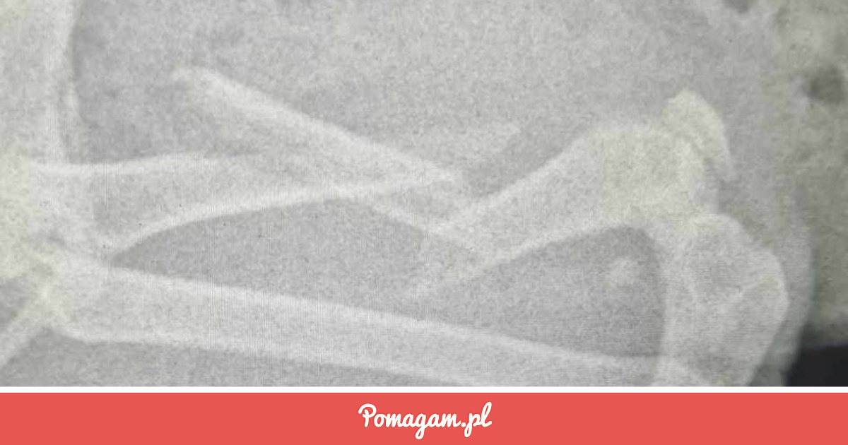 Zrzutka na Operacja Złamanej Nogi Mufiego - Amelia Ok | Pomagam.pl