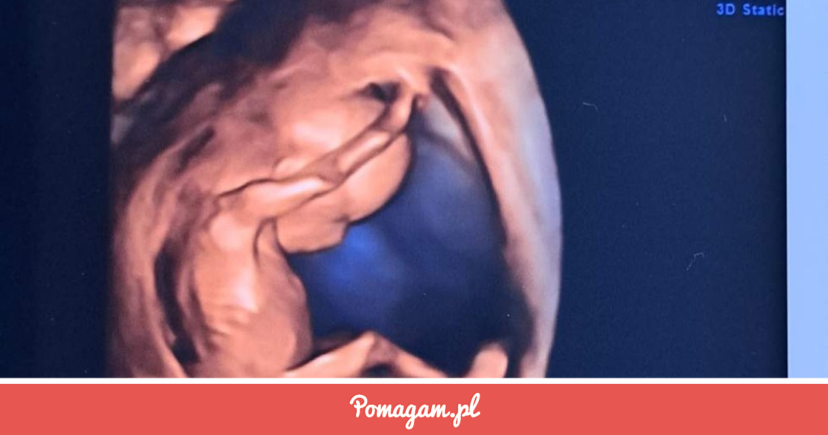 Zrzutka na Ofiara Cyberprzestepcow - Pawel Wrobel | Pomagam.pl