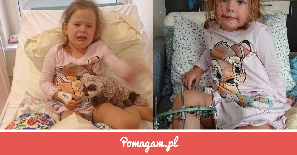 Zrzutka na Uratujmy Eryczkę przed Kalectwem - Fundacja bo w Nas Jest Moc | Pomagam.pl