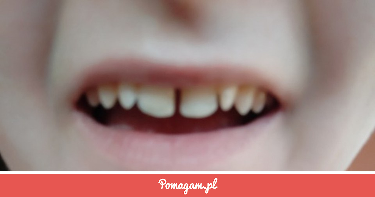 Zrzutka na Aparat Orat. na Zeby - Agnieszka Sawa | Pomagam.pl
