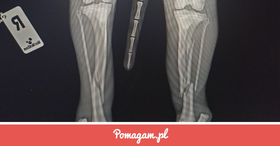 Operacja dla naszego psa Roko - Łukasz Rakowski | Pomagam.pl