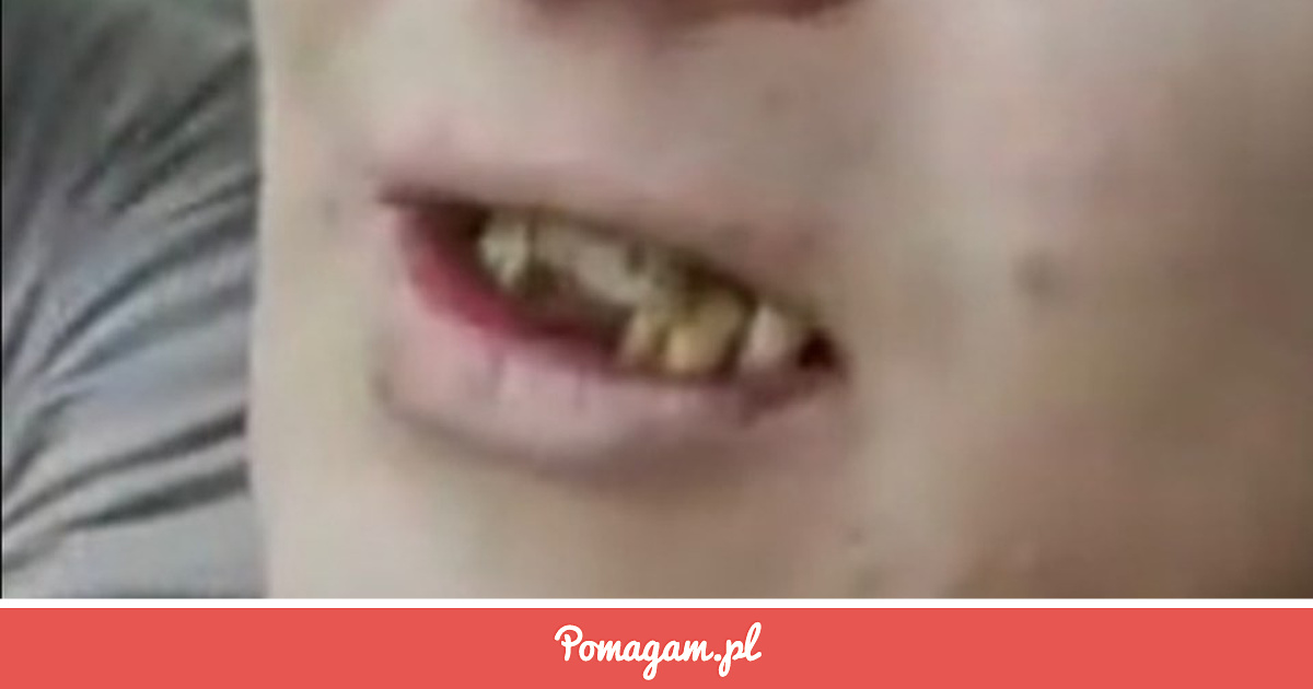 Zrzutka na Zbieramy Kwotę na Uzębienie Moni - Monika Bytnar | Pomagam.pl