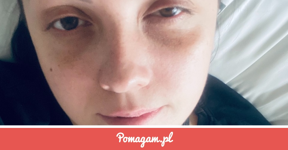 Zrzutka na Sprawność po udarze - Marta Wojtan | Pomagam.pl